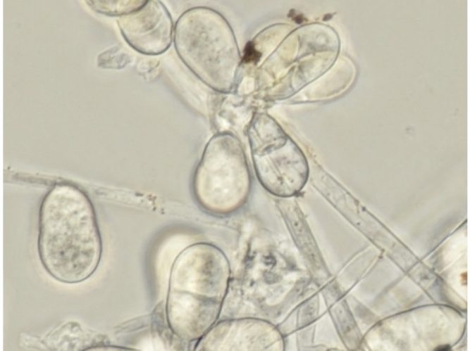 ‘Forgotten conservation targets’: the hidden world of aquatic fungi ...